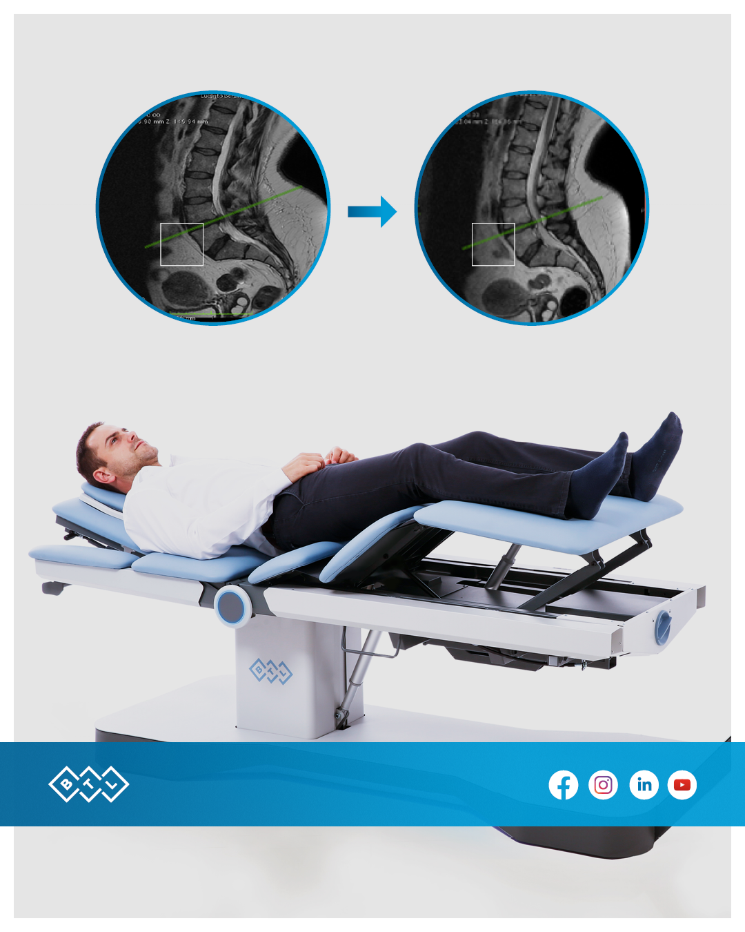Spinal Decompression – A Balanced Body